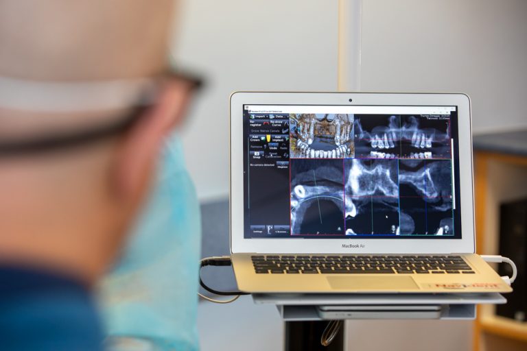 Navident and Dental Implants - Westerly, RI - Dr. Toback